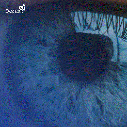 Eyedaptic | StartEngine